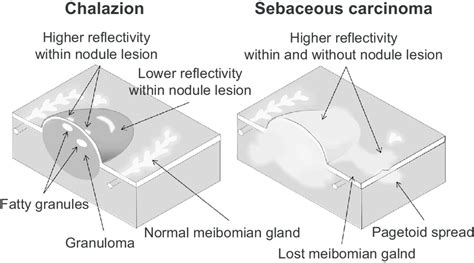 Schematic Representation Of The Relationship Between Pathological