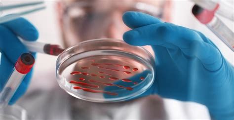 Neoplasias Hematológicas O Que Você Precisa Saber Sobre O Assunto