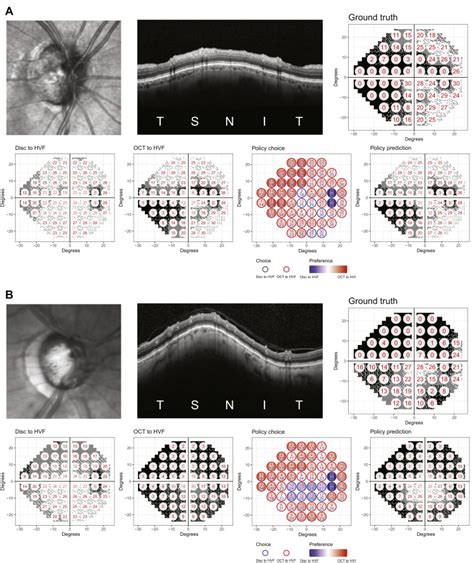 Policy Driven Multimodal Deep Learning For Predicting Visual Fields From The Optic Disc And Oct