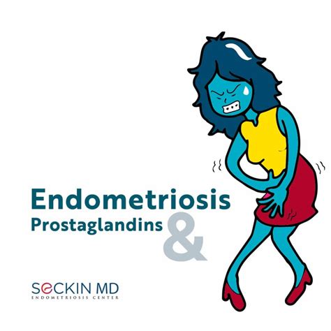 Endometriosis And Prostaglandins Seckin Endometriosis Center