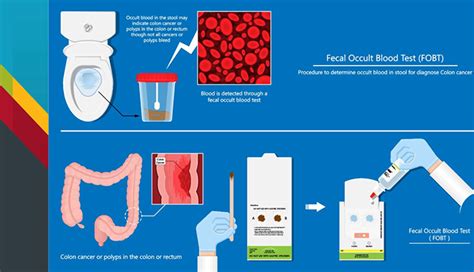 Colon Cancer Screening Cartoon
