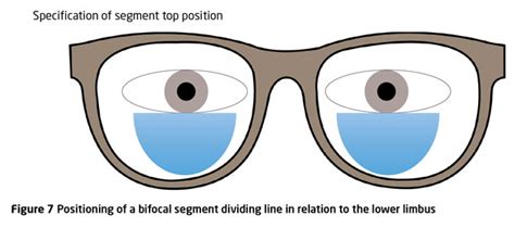 Optician Online Cpd Archive