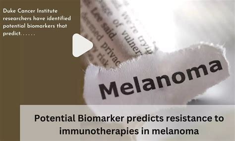Potential Biomarker Predicts Resistance To Immunotherapies In Melanoma