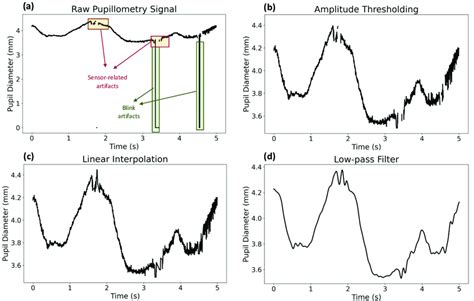 Pupillometry Pre Processing Steps A Raw Pupil Diameter Signal B