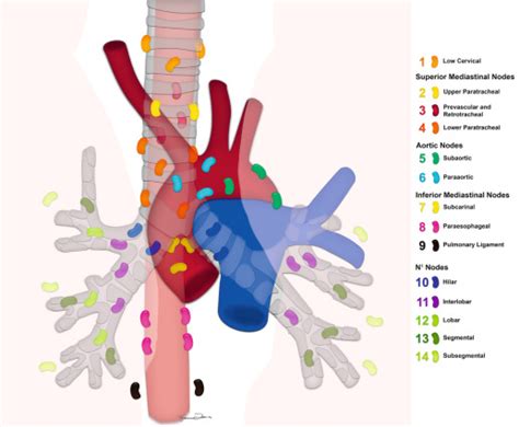 Lung Cancer Staging Clinical Tree