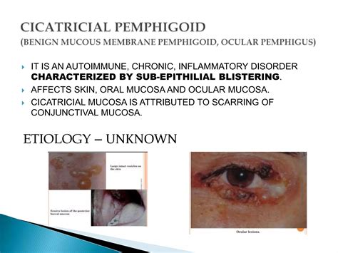 Pemphigus And Pemphigoid Pptx