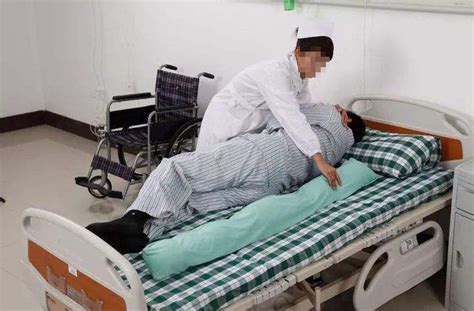 253粗隆间骨折之保守vs手术篇 知乎