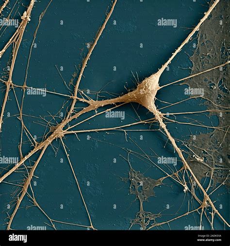 Spinal Ganglion Nerve Cells Coloured Scanning Electron Micrograph Sem