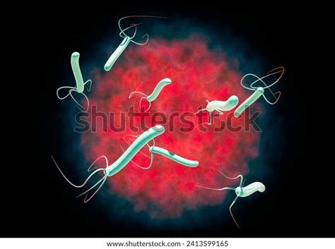 Helicobacter Pylori Gramnegative Flagellated Helical Bacterium Stock Illustration 2413599165