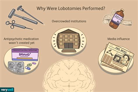 Lobotomy History Procedure Lobotomys Controversial History As A