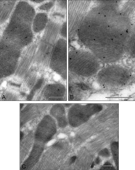 Immunogold Labelling Of Wild Type Mouse Heart A Ptcd2 Download