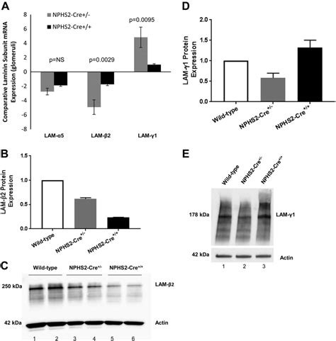 Expression Of Mature Isoform Laminin 521 Lam 521 In Glomeruli Of