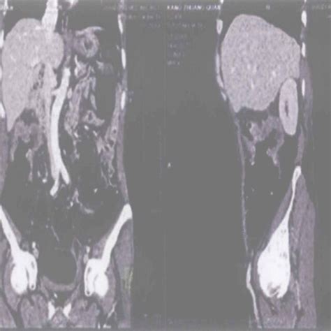 Scanned Image Of Ct Reconstruction Image After Enhancement Download