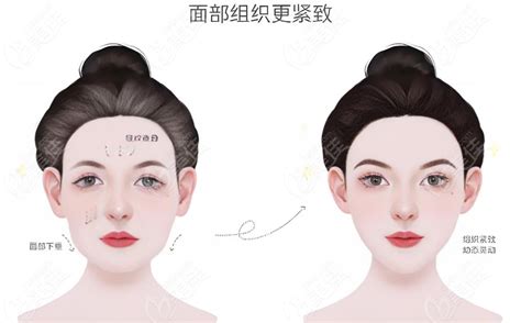 【杭州整形医院排名前十位】杭州排名前3和排名前1的整形医院尤其出名 美佳社区