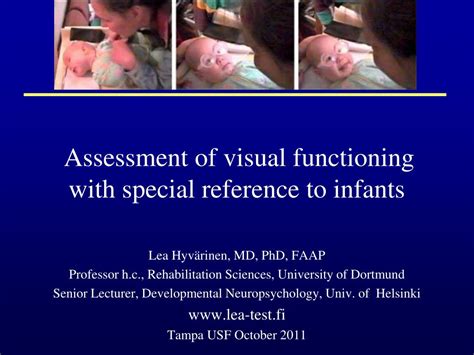 Ppt Assessment Of Visual Functioning In Infants Key Indicators And Recommended Practices