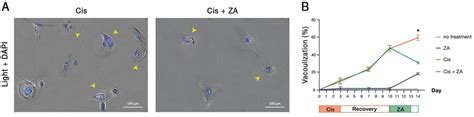 Cytoplasmic Vacuolization Is A Common Morphology In Cisplatin Induced
