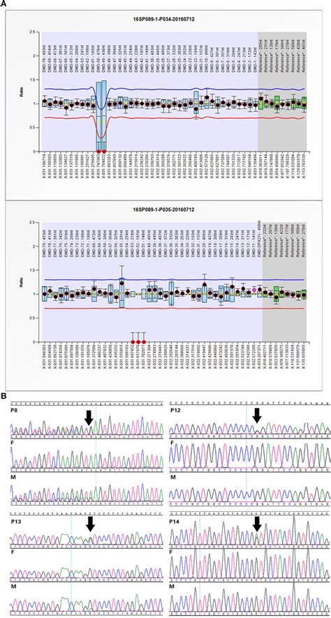 Figure 1 From Whole Exome Sequencing Aids The Diagnosis Of Fetal