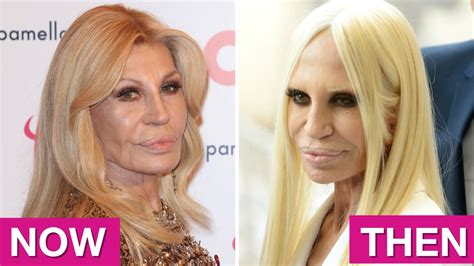 Pics Reveal Donatella Versaces New Unrecognisable Face Best Celeb