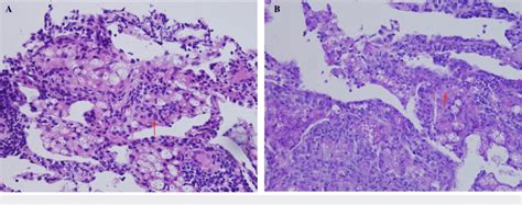 Histopathology Of One Case Download Scientific Diagram