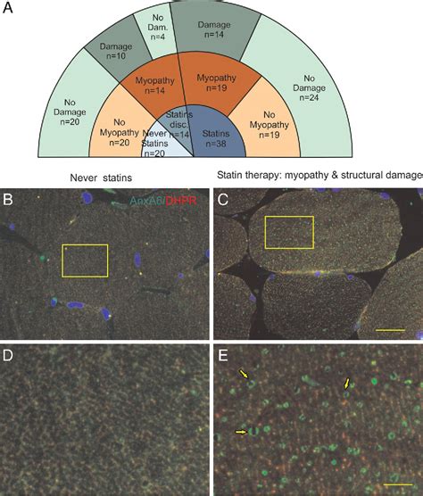 Figure 1 From Statin Therapy And The Expression Of Genes That Regulate