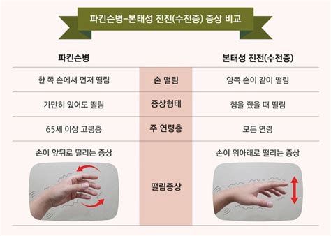 손 떠는 수전증 파킨슨병 증상의 차이와 치료법은