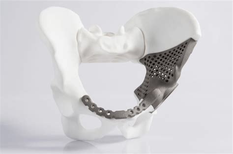 The Ultimate List Of What We Can 3d Print In Medicine And Healthcare