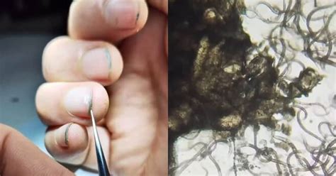 शख्स ने नाखून में से निकाला मैल माइक्रोस्कोप में दिखाई असलियत देखते ही छोड़ देंगे नाखून चबाने