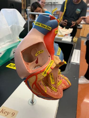 Practicum 3 Heart And Large Vessels Flashcards Quizlet