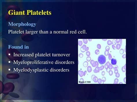 Ppt Wbcs And Plt Abnormal Morphology Powerpoint Presentation Id6378150