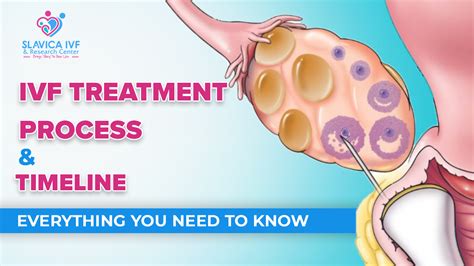 Ivf Treatment Process And Timeline Best Ivf Center In Nepal