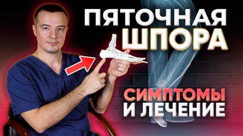 Как избавиться от пяточной шпоры советы травматолога ортопеда по терапии Плантарного фасциита