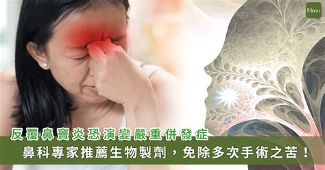 反覆鼻竇炎治不好，連手術都沒用！鼻科專家建議，用「這」藥物減少復發與反覆手術 蕃新聞