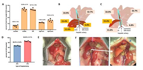 Isolation Of Regenerating Hepatocytes After Partial Hepatectomy In Mice