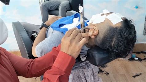Earwax Removed In Cambodia Asmr 2022 Youtube