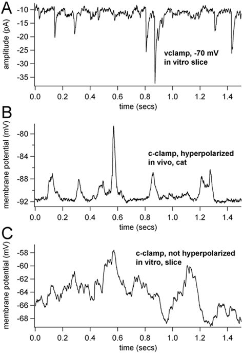 Intracellular Recordings In Different Conditions A Whole Cell