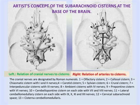 Cisterns Of Brain