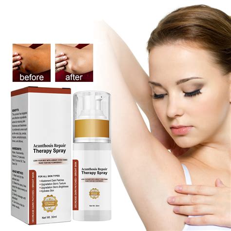 Niviya Body Care Clearance System Care Lotion Black Thorn Skin Care Spray To Clean Cutin Melanin
