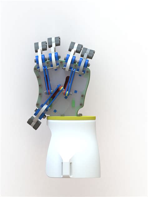 Smart Prosthetic Hand A Revolution In Prosthetic Technology・ Stl File