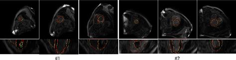 An Automatic Cardiac Segmentation Framework Based On Multi Sequence Mr