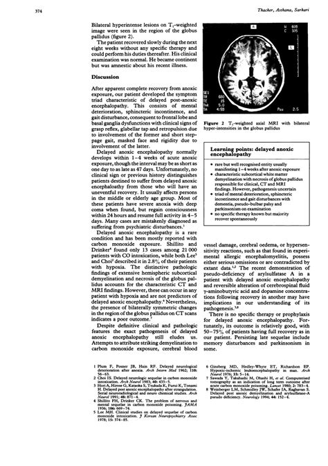 Delayed Post Anoxic Encephalopathy Pmc