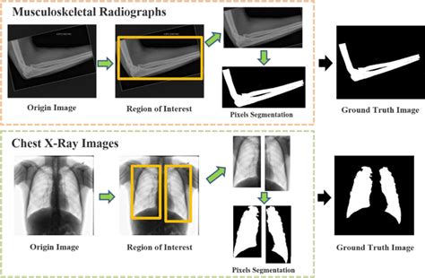 Examples Of Medical Images In Two Datasets And Manual Segmentation