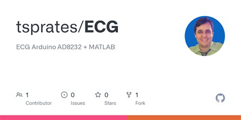 Github Tsprates Ecg Ecg Arduino Ad Matlab