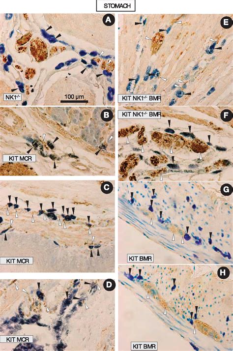 Figure 3 From Lack Of Neurokinin 1 Receptor Expression Affects Tissue