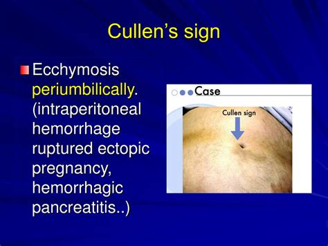Ppt Abdominal Examination Powerpoint Presentation Free Download Id