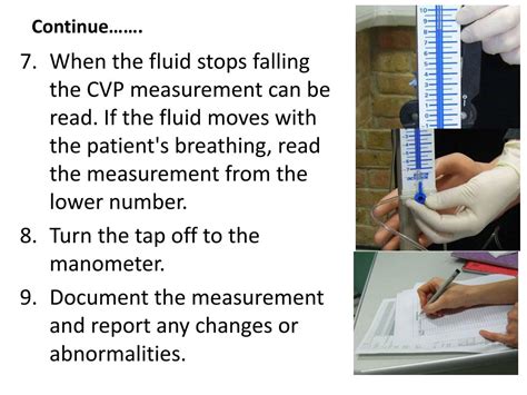 Ppt Central Venous Line Cvl And Central Venous Pressure Cvp