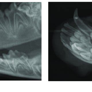 Radiographical Image Of The Right Mandible A Prior To DPC B 14
