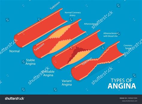 3d Isometric Flat Vector Illustration Types Stock Vector Royalty Free
