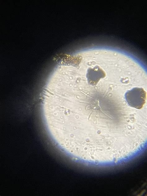 Amoeba Hello Ive Been Getting Into The Cast World Of Soil Microscopy