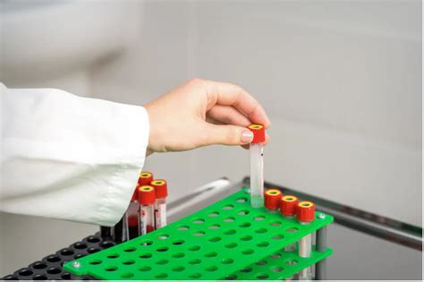 Genetics And Testing Weill Cornell Imaging At Newyork Presbyterian