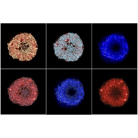 Protein Fluidics Gallery
